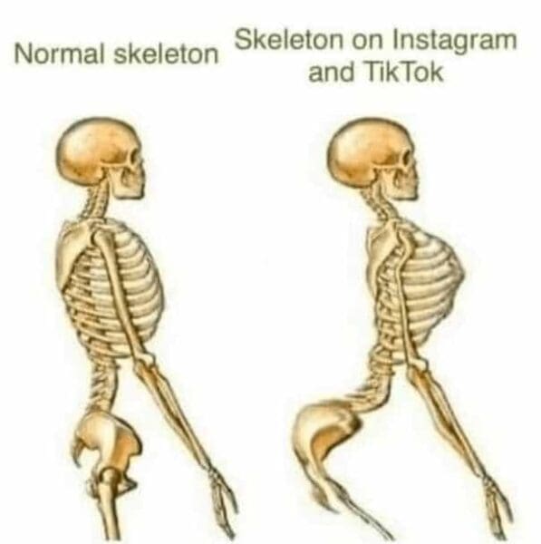 Got Back Pain? 17 Back Pain Memes for Everyone of My Slouching Brethren