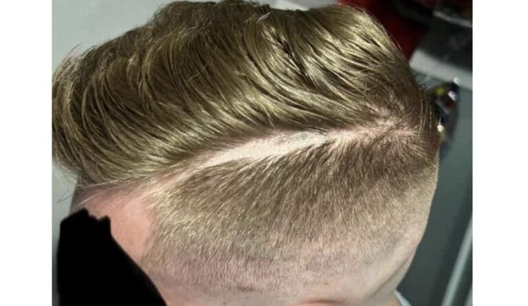 19 Hair Crimes: A Rogues' Gallery of the Worst Haircuts Ever