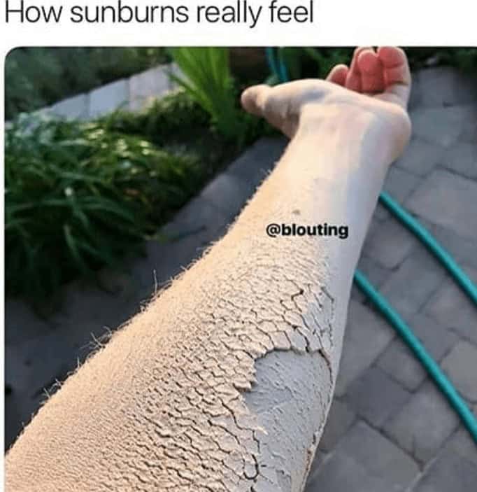 sunburn memes-27-4-23-2024 - Thunder Dungeon | The Funniest Memes. Period.