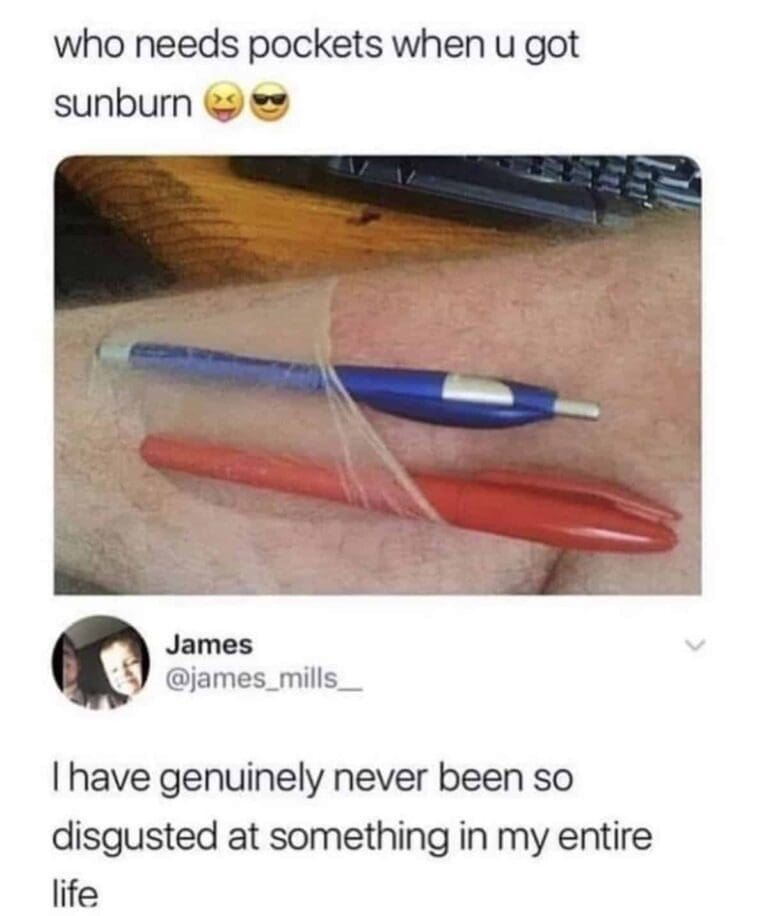 33 Sunburn Memes: Because Apparently, You Needed Another Reminder to ...
