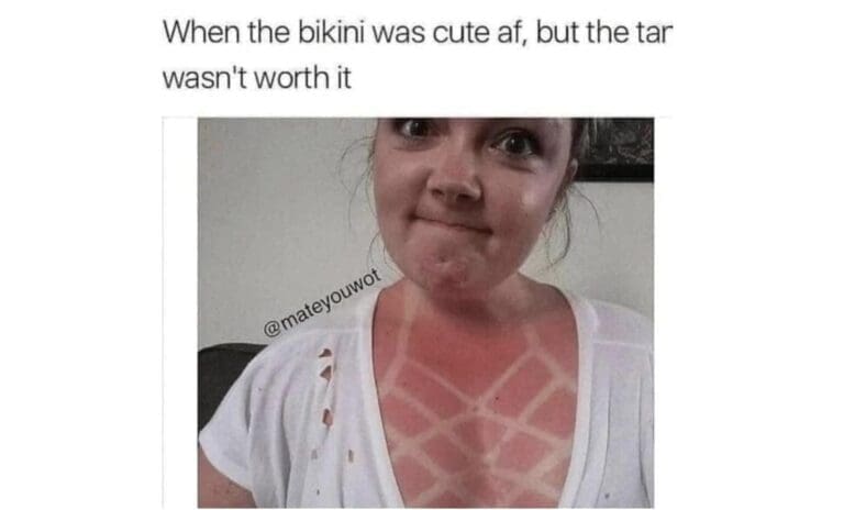 35 Bad Sunburn Memes That Will Make You Laugh Through the Pain