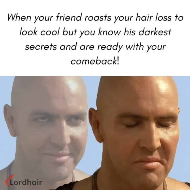 Bald Memes: 30 Memes Appreciating the Bald Fellas