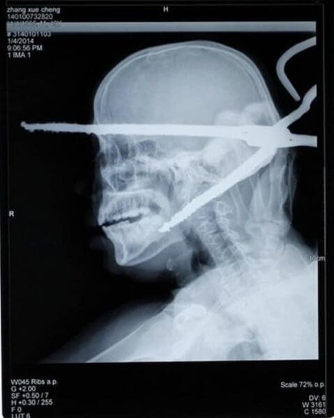 31 Weird X-Ray Photos That (Yes) They Really Are Real