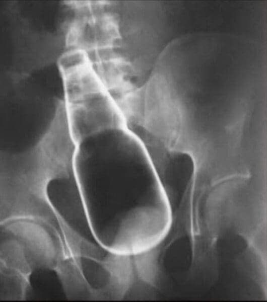 31 Weird X-Ray Photos That (Yes) They Really Are Real