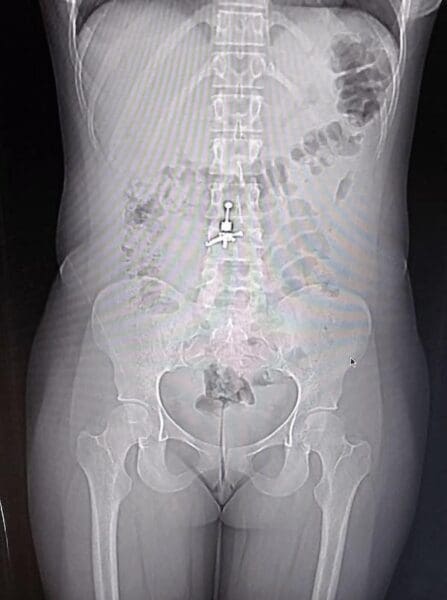 31 Weird X-Ray Photos That (Yes) They Really Are Real