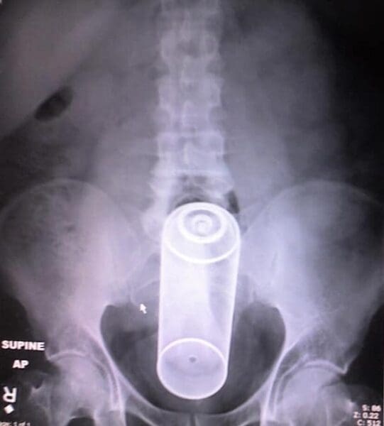 31 Weird X-Ray Photos That (Yes) They Really Are Real